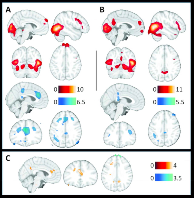 People Who Commit Domestic Violence Have Different Brain Activity Than ...